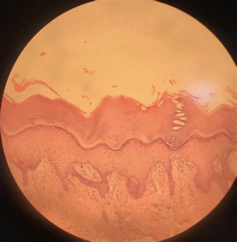 Histo Lab Final Flashcards Memorang