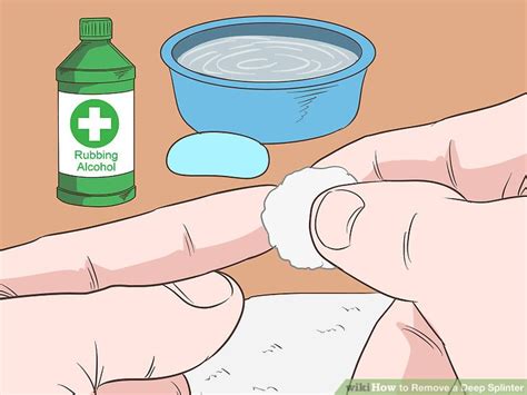 Ways To Remove A Deep Splinter WikiHow