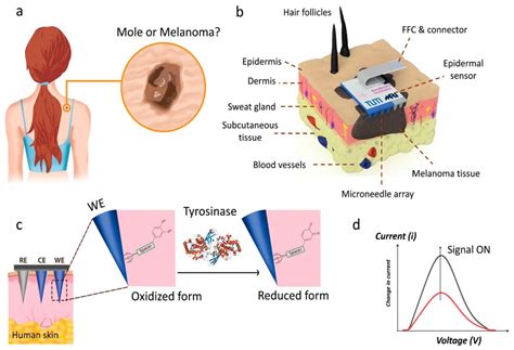 Microneedle Sensors The Tiny Revolution In Wearable Diagnostics Alta