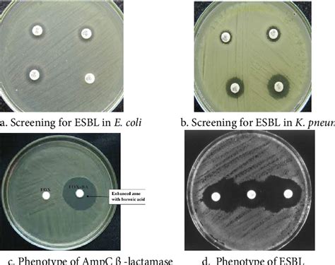 Figure 2 From The Status Of Extended Spectrum β Lactamase And Ampc β