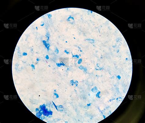 在医学实验室进行结核微杆菌测试。