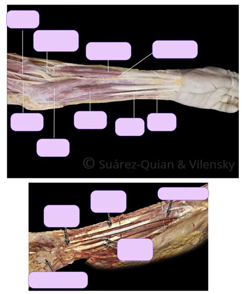 Upper Extremity Lower Arm Muscles Part 3 Diagram Quizlet