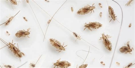 Can Lice Nits Survive In Extreme Temperatures Lice Nits
