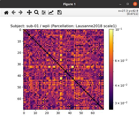 Graphical User Interface — Connectome Mapper 3