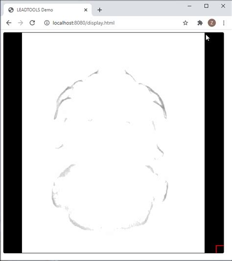 Tutorial View Dicom Images From Anywhere With Leadtools Html5 Medical Viewer Leadtools Blog