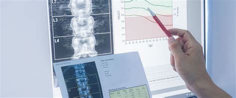 Bone Density Scan Medical Imaging Of Fredericksburg Medical Imaging