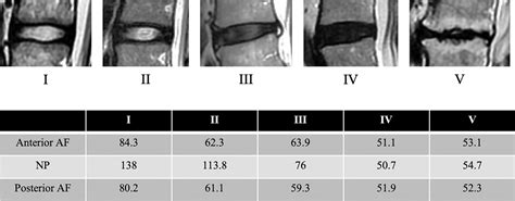 Imaging Diagnosis For Intervertebral Disc Ogon 2020 Jor Spine