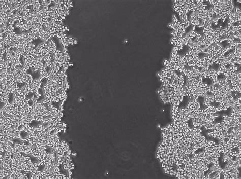 60 Questions With Answers In Hct116 Cells Science Topic