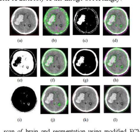 Figure 1 From Biomedical Image Segmentation Using Integrated Fcm