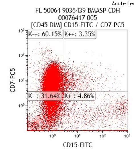 Pathology Outlines Transient Abnormal Myelopoiesis Associated With
