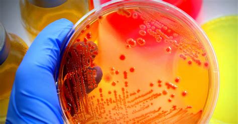 Charcoal Yeast Extract Agar At Donald Blanton Blog