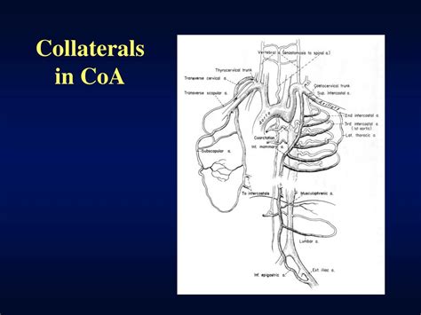 Ppt Coarctation Of Aorta Powerpoint Presentation Free Download Id