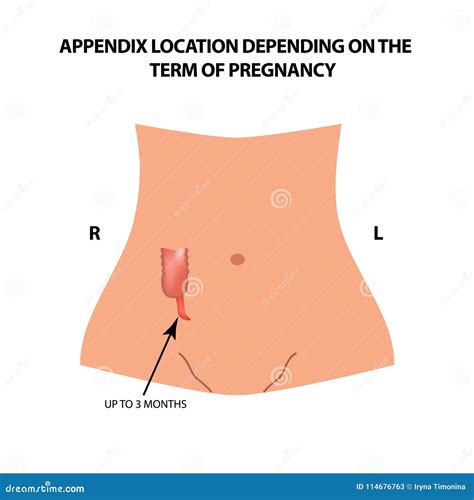 Location Of The Appendix Under The Liver The Appendix Under The Liver Infographics Vector