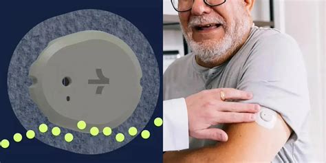 Fda Approves First Otc Glucose Monitor Dexcoms Stelo System And It