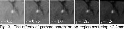 Figure 3 From Automated Brain Metastases Detection Framework For T1