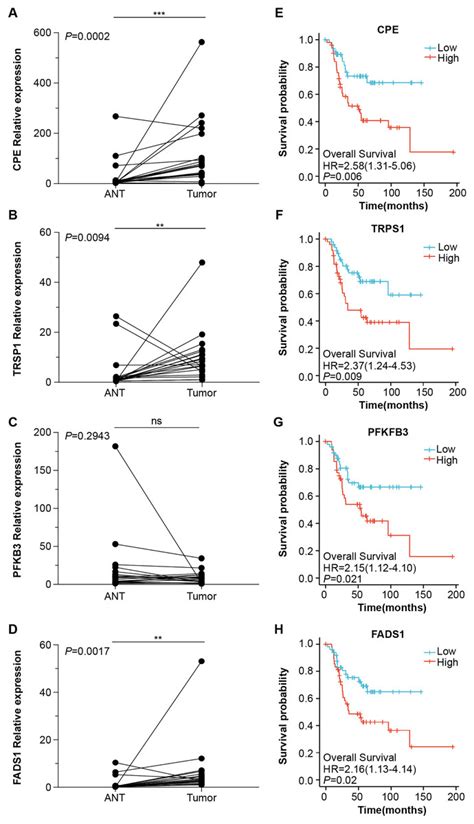 Carboxypeptidase E Is A Prognostic Biomarker Co Expressed With Osteoblastic Genes In