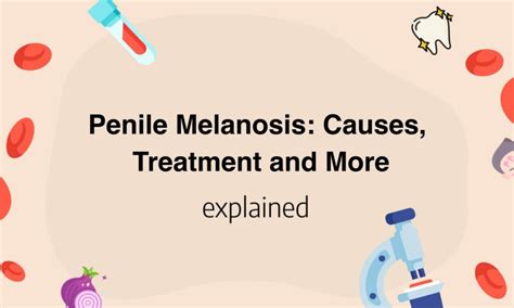 Penile Melanosis Causes Treatment And More