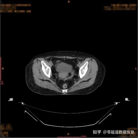🔍【真实案例复盘】一次教科书式错误操作引发的数据灾难：8块硬盘的sun服务器如何起死回生？ 知乎