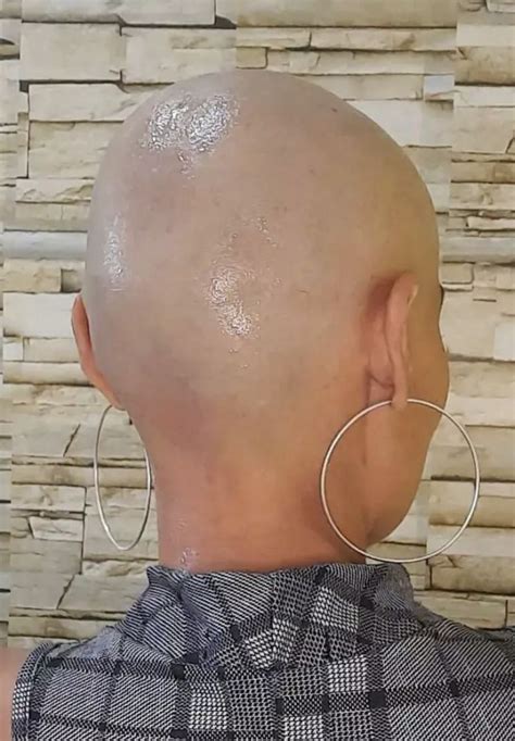Pin By Mauricio Silva On Beautiful Bald Girls In 2025 Bald Women Bald Head Women Bald Girl