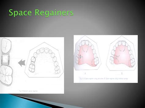 Interceptive Finalpptx