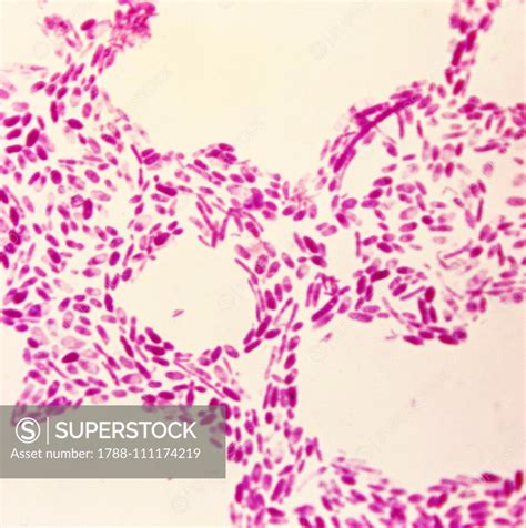 Acetobacter Bacteria Seen Under A Microscope With Counterstaining At