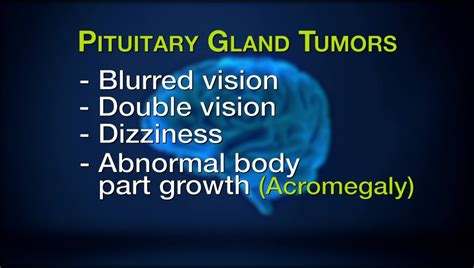 Pituitary Gland Tumor Symptoms In Women