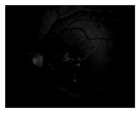 image obtained with bright region extraction algorithm download