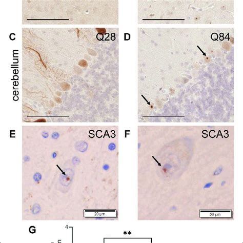 Polyq Expanded Atxn3 Forms Inclusions In Sca3 Mice A D