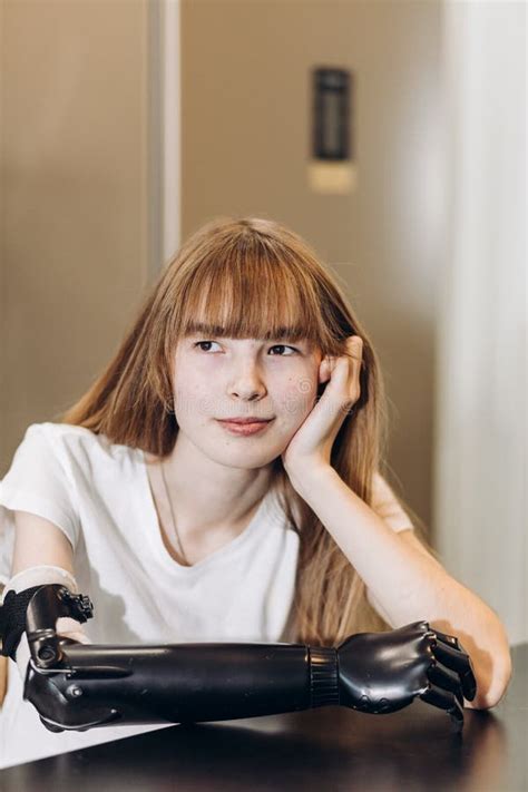 Attractive Pensive Girl With Amputated Arm Sitting At The Table Stock