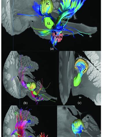 Fiber Tracts Between The Brainstem And Midbrain Auditory Nuclei Using A Download Scientific