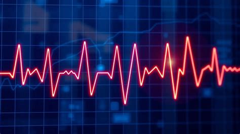 How Do I Cover My Short Position In Stock Trading