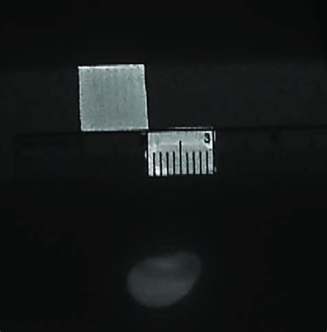 Near Infrared Autofluorescence Image Of Parathyroid Adenoma With No Download Scientific Diagram