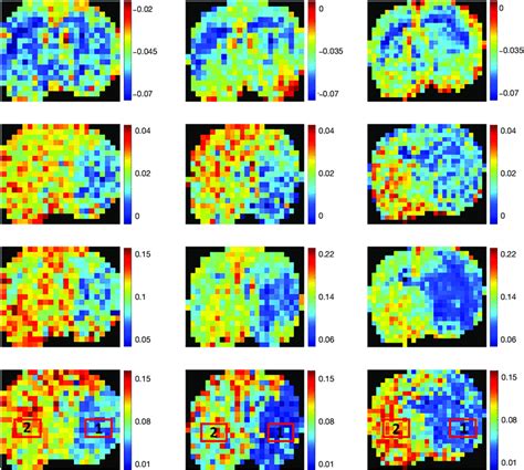 Comparisons Of Different Quantification Methods During A Temporal