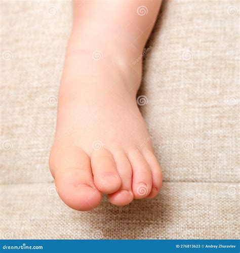 Overlapping 5th Toe
