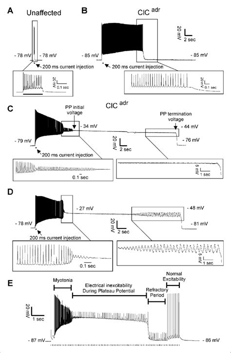Plateau Potentials In Clc Adr Muscle For A D The Insets Show Portions Download Scientific