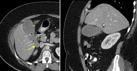 What Is Ct In Radiology At Bret Stephen Blog