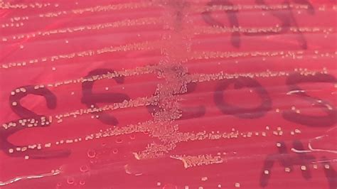 Staphylococcus Sciuri Introduction Morphology Pathogenicity Lab