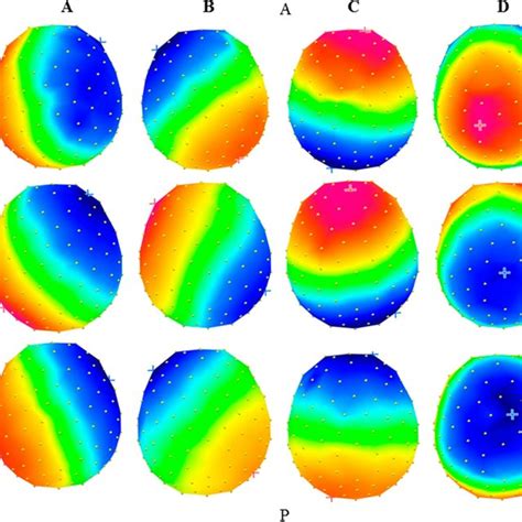 Eight Scalp Topographical Template Maps Representing Resting Eeg