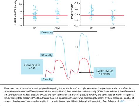 Invasive Hemodynamic Assessments To Differentiate CP And RCM 30 Download Scientific Diagram