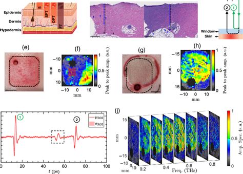 A The Anatomy Of The Skin Layers Composed Of Epidermis Dermis And Download Scientific