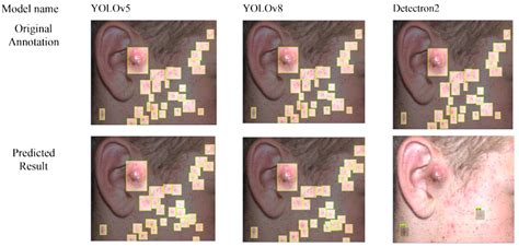 Biomedinformatics Free Full Text Utilizing Generative Adversarial Networks For Acne Dataset