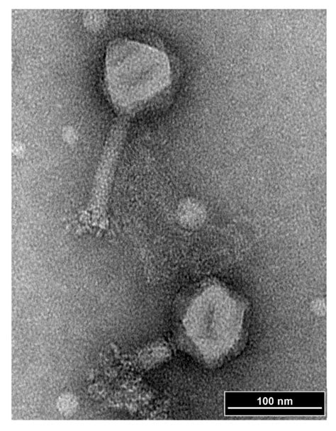 Electron Micrograph Of Phage Φsbom Ag3 The Phage Has Been Negatively