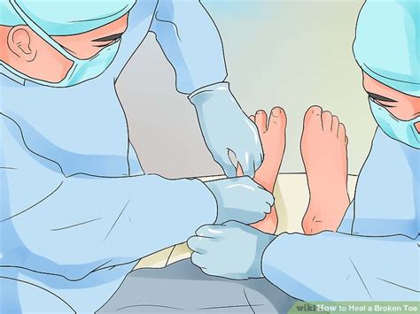 How To Heal A Broken Toe 13 Steps With Pictures WikiHow
