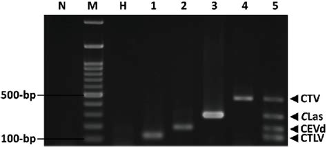 Figure 1 From Development Of Multiplex Rt Pcr Assay For The Simultaneous Detection Of Four