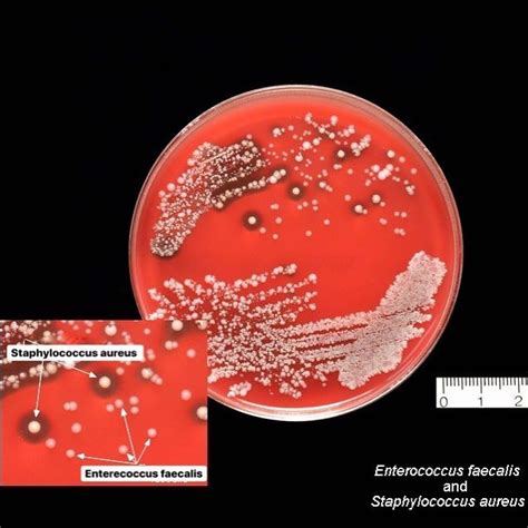Stafilococco Aureus Yaswfi