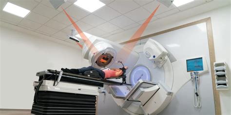 AlignRT DIBH For Reduced Radiation Toxicity Vision RT