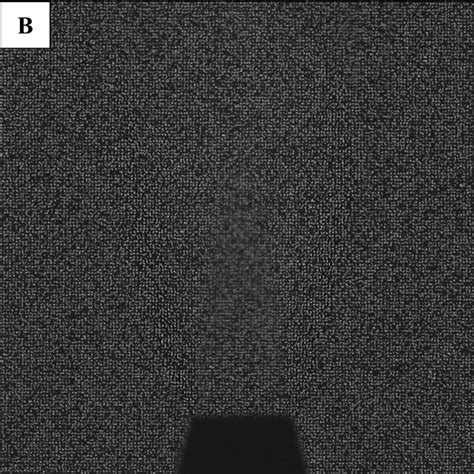 A Undistorted Background B Distorted Background C Distorted Download Scientific Diagram