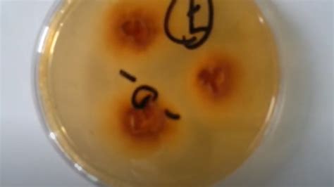 Dermatophytes Classification Archives Medical Notes