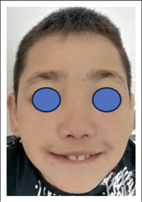 Figure 1 From Comprehensive Clinical And Genetic Characterization Of