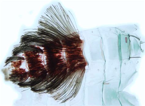 Sex Scales On Abdomen Of Male Of Fibuloides Geniculata Pinkaew And Download Scientific Diagram
